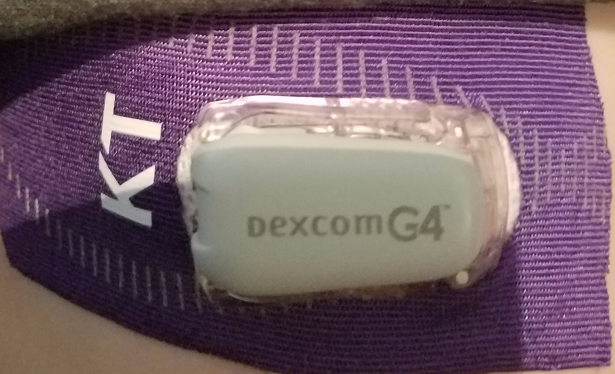 Dexcom: The Good, The Bad, and The Obsessive – Triumphs, Tantrums, and ...